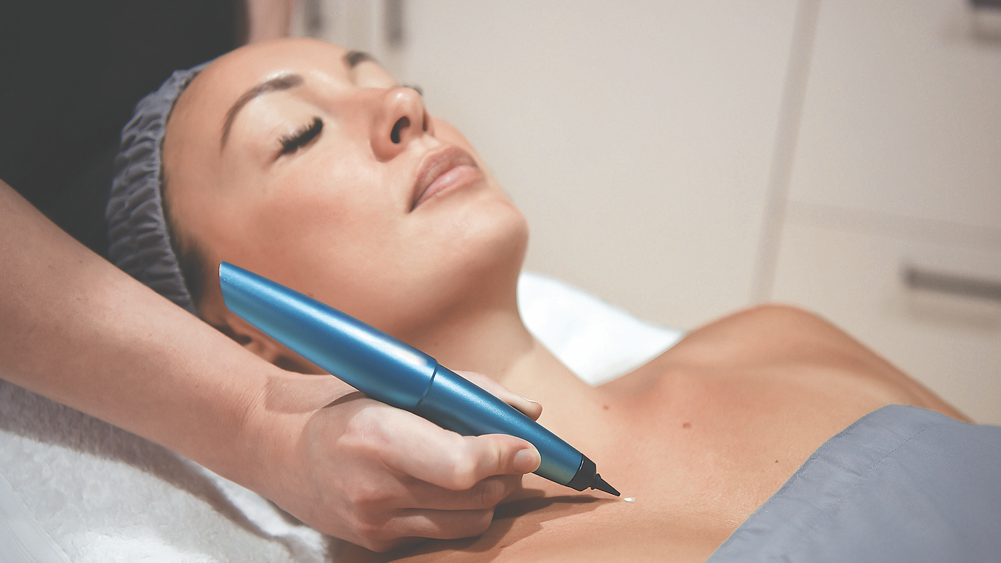 Skin Tag Removal Rotherham | CryoPen at Enhance Clinic